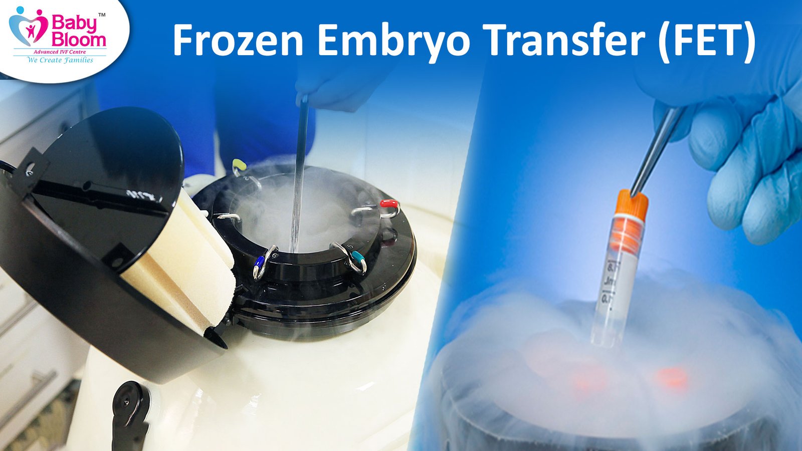 Frozen Embryo Transfer (FET) Guide: Top Benefits, Success Rates, and Tips