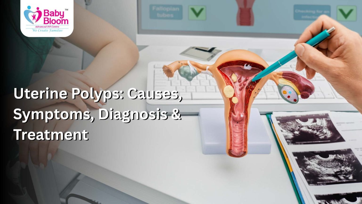 Uterine Polyps: Causes, Symptoms, Diagnosis & Treatment - BabyBloom IVF